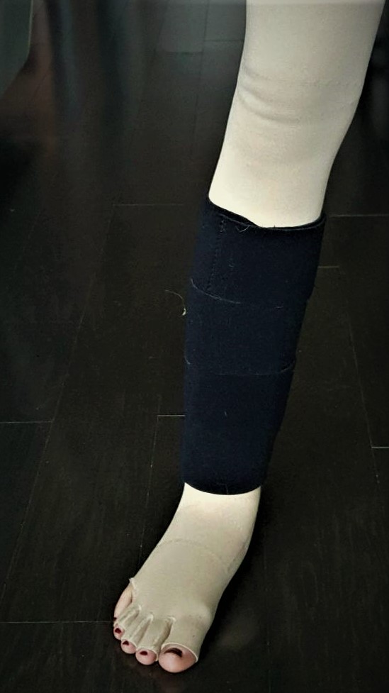 lymphie-life-biacare-compreflex-lite-closeup-leg