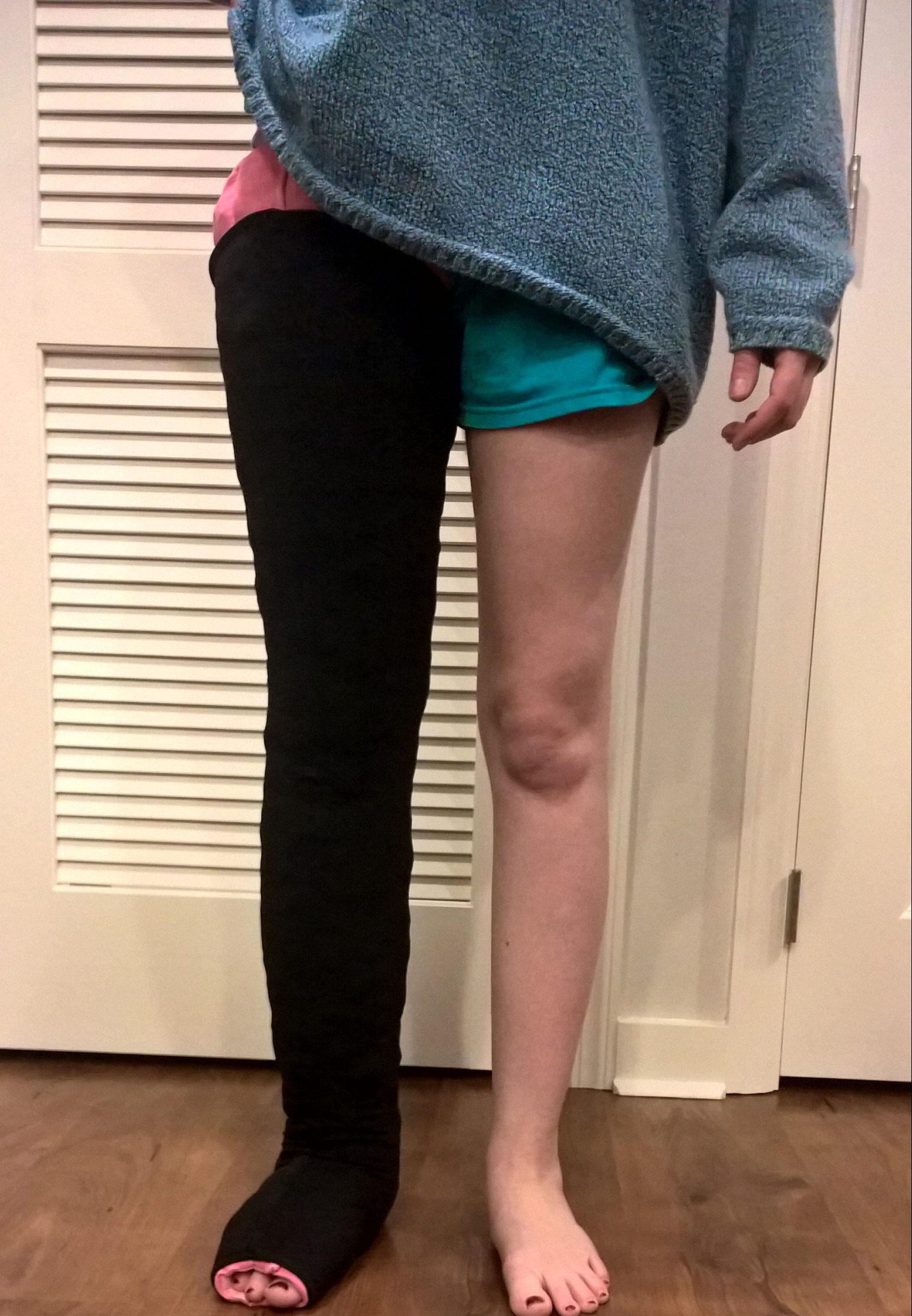 Product Review: Getting Relaxed with the Jobst Relax